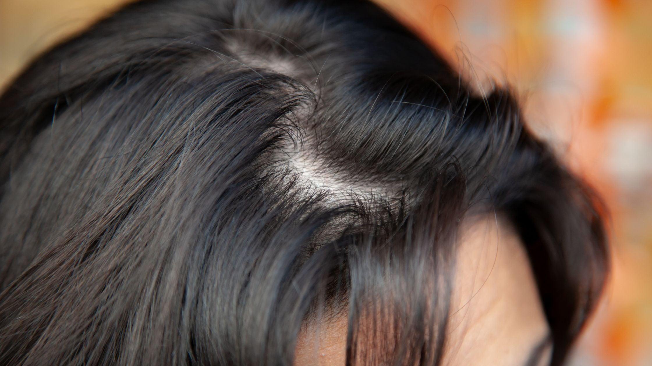 The Ultimate Guide to Hair Hydration: Tips for Achieving and Maintaini ...