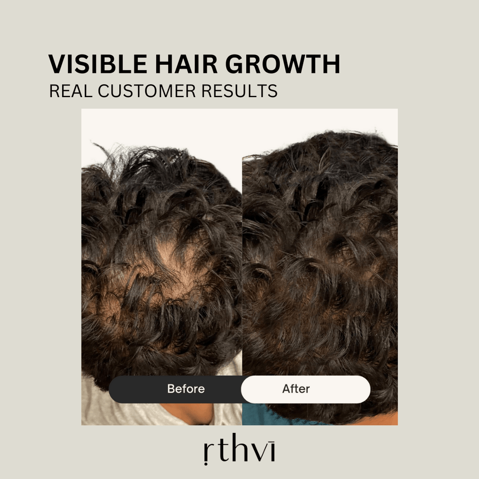 Best Rosemary Oil for hair growth | Rthvi