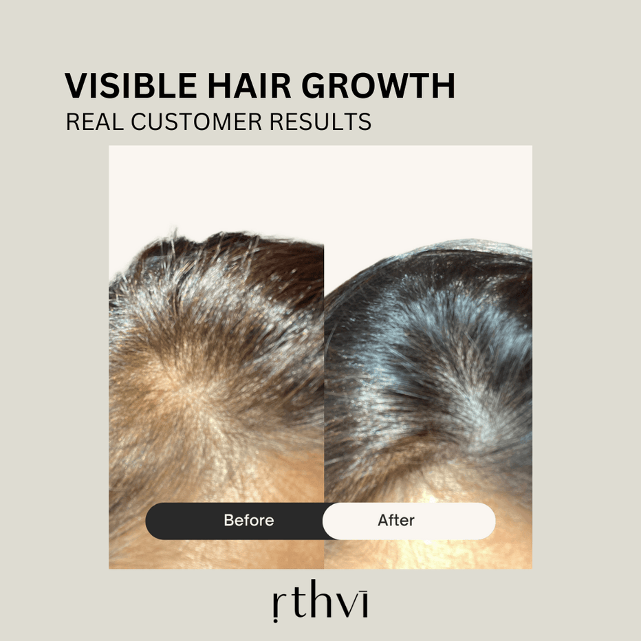 Best Rosemary Oil for hair growth | Rthvi