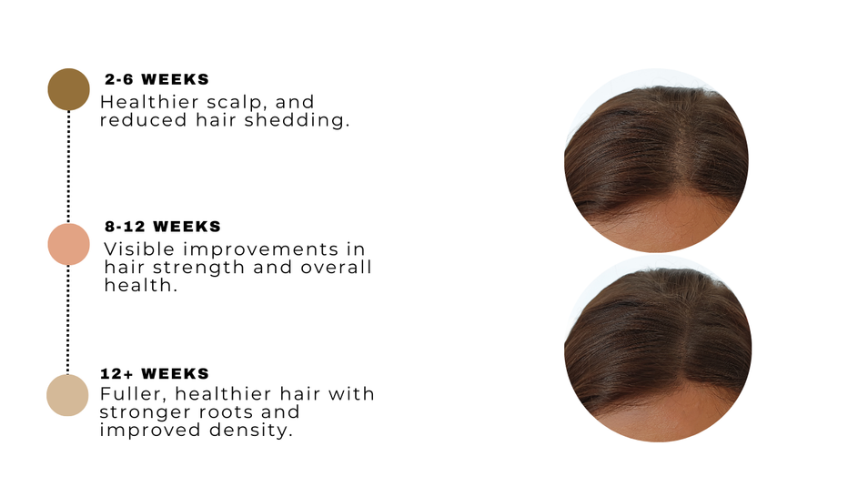 Best Rosemary Oil for hair growth | Rthvi